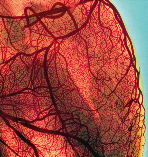 Diagnosis and pharmacological management of stable angina ...